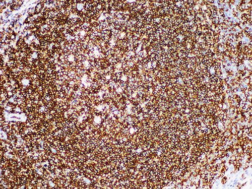 CD45 (LCA) Monoclonal Antibody | Elabscience Biotechnology