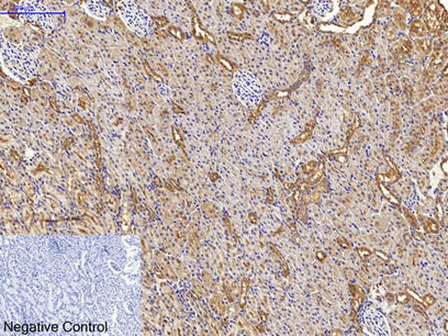 MAP1LC3A Monoclonal Antibody | Elabscience Biotechnology