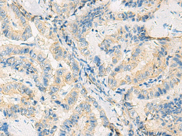 SYNGR1 Polyclonal Antibody Reactivity Human | Elabscience Biotechnology