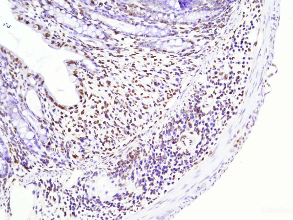 TUNEL In Situ Apoptosis Kit (HRP-DAB Method) | Elabscience Biotechnology