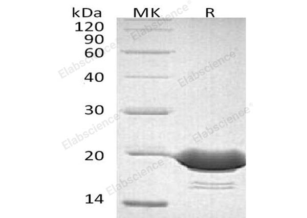 Recombinant Human 4-1BBL/TNFSF9 Protein (His Tag)(Active) | Elabscience ...