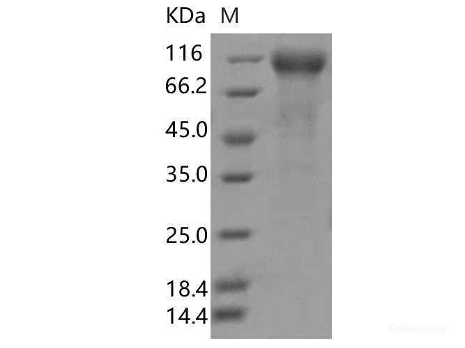 Recombinant SARS-CoV-2 Spike S1(ΔHV69-70, N439K, D614G)(His Tag ...