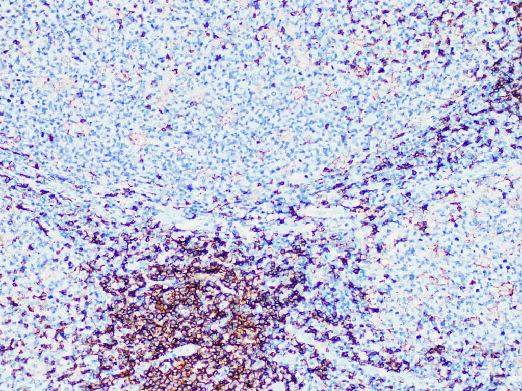 CD4 Monoclonal Antibody Stored at -20°C | Elabscience Biotechnology