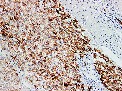 CK18 Monoclonal Antibody Stored at -20°C | Elabscience Biotechnology
