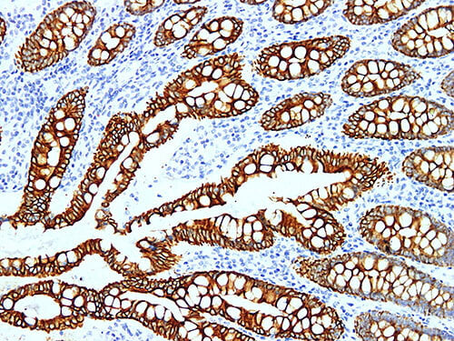 CK19 Monoclonal Antibody Stored at -20°C | Elabscience Biotechnology