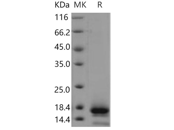 Recombinant Human TSPAN8/Tetraspanin 8 Protein (His Tag) | Elabscience ...