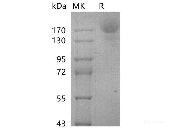 Recombinant SARS-CoV-2 S-stable trimer Protein (C-6His)(Active) – MSE ...