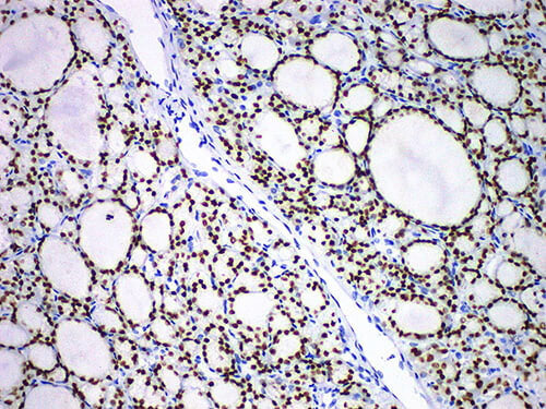 TTF-1 Monoclonal Antibody Stored at 2~8°C Host Mouse | Elabscience ...