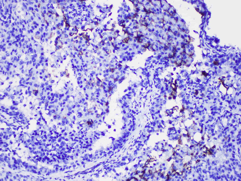 Uroplakin III Monoclonal Antibody Stored at -20°C